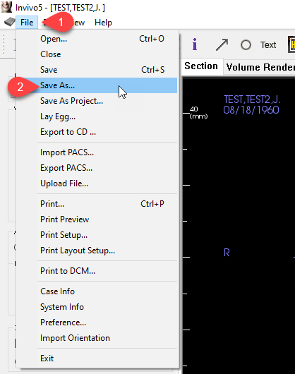 Export CBCT Scan to InVivo Viewer File – FCD - Help Desk