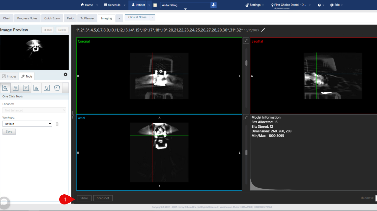 Viewing CBCT Images in External Software – FCD - Help Desk